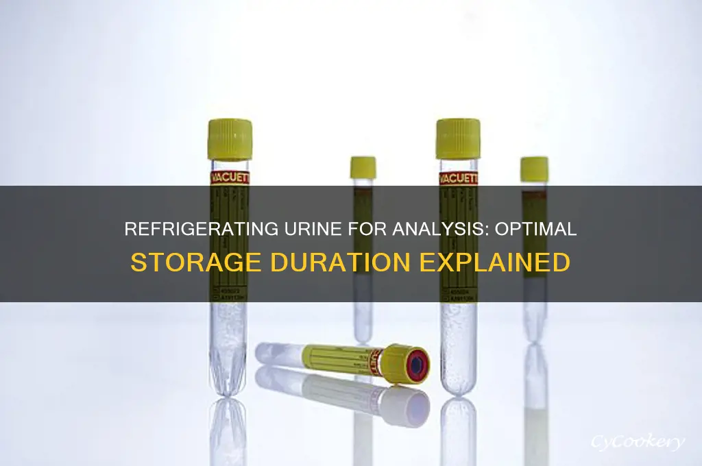 Refrigerating Urine For Analysis: Optimal Storage Duration Explained ...