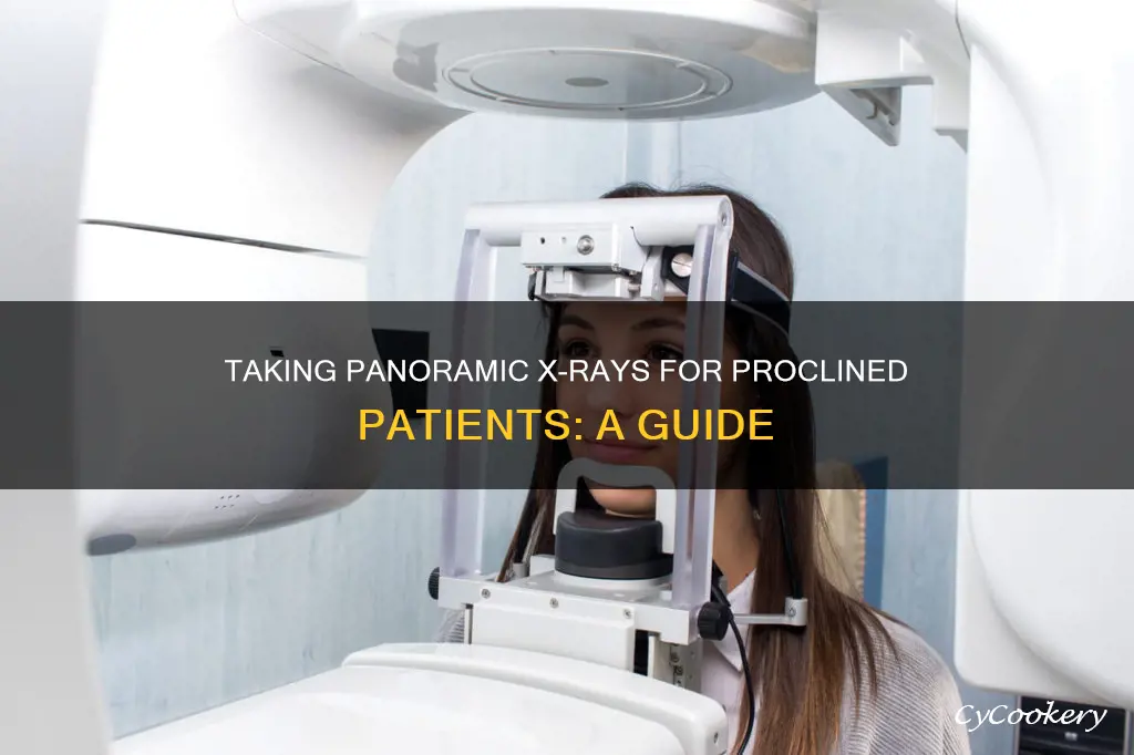 Taking Panoramic X-Rays For Proclined Patients: A Guide | CyCookery