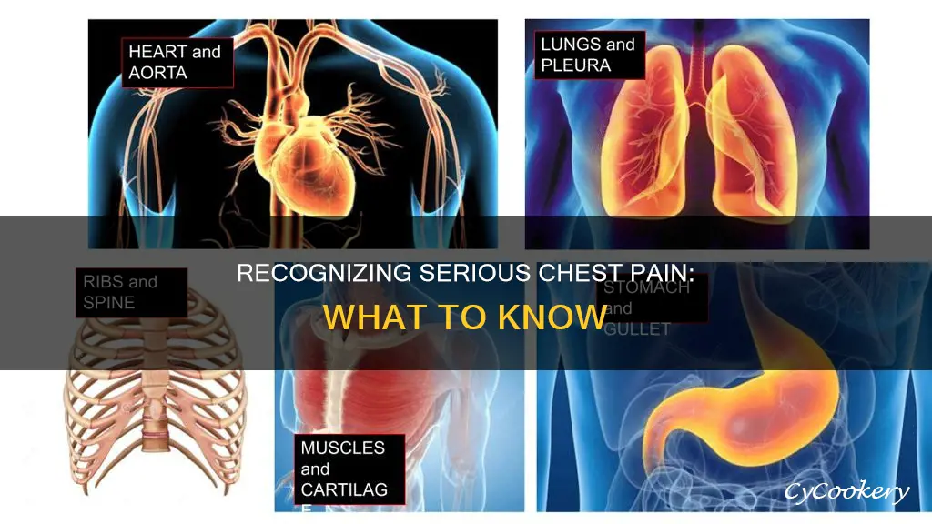 Recognizing Serious Chest Pain: What To Know | CyCookery